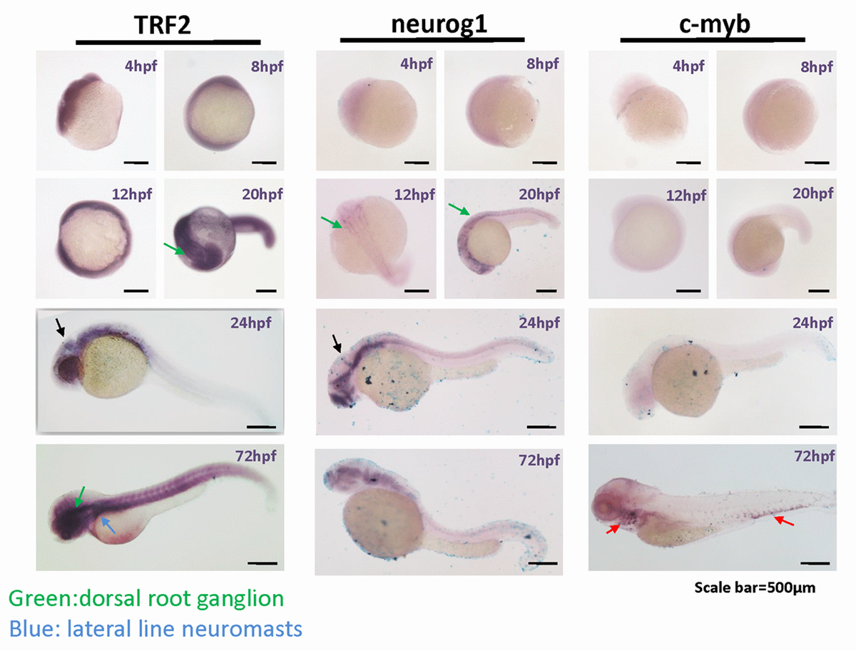 The Differential Spatiotemporal Expression Pattern Of Shelterin Genes