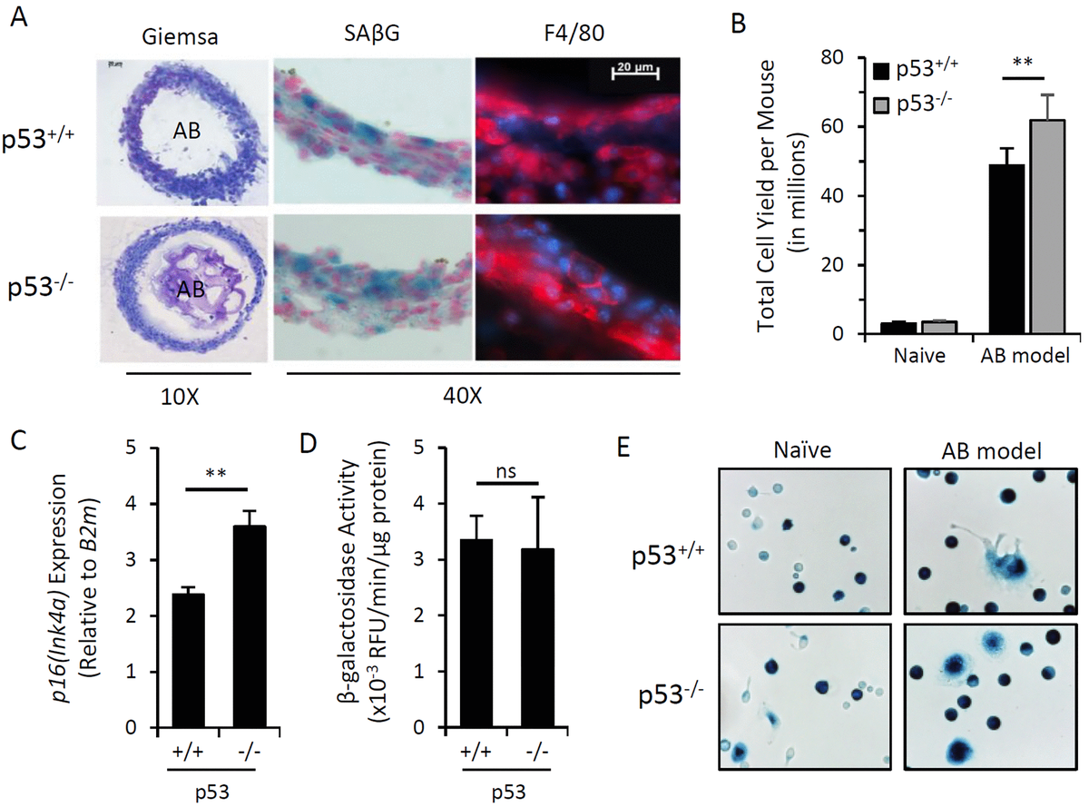 p16(Ink4a) and senescence-associated β-galactosidase can be induced in ...