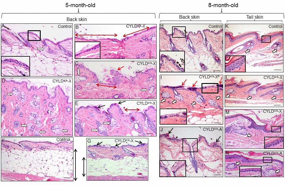 Premature aging and cancer development in transgenic mice lacking ...