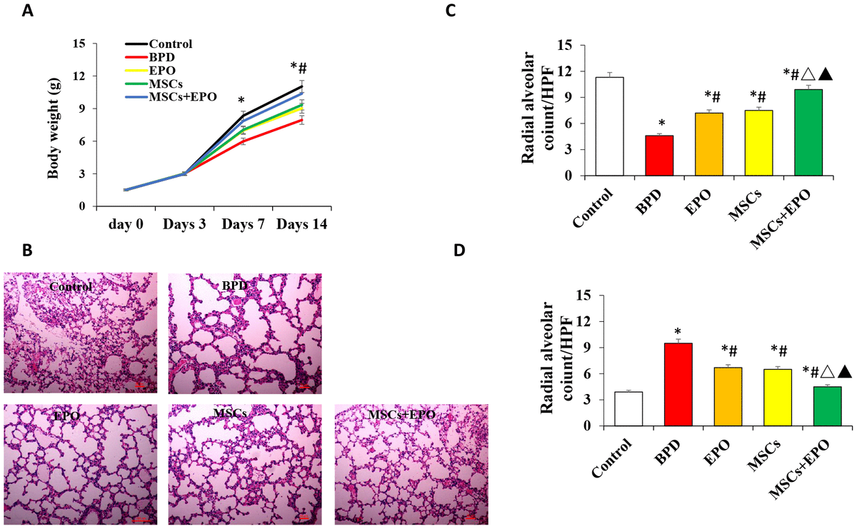 EPO enhances the protective effects of MSCs in experimental hyperoxia ...