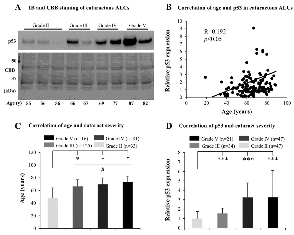 Laminin α4 overexpression in the anterior lens capsule may contribute ...