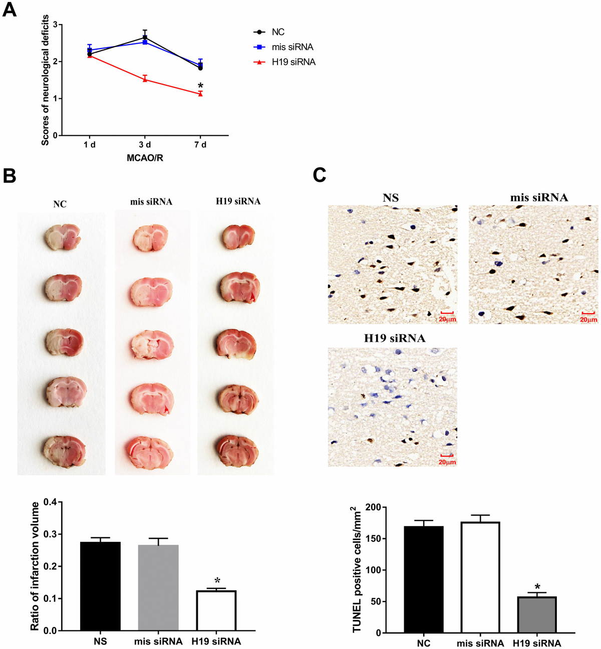 Blocking lncRNA H19-miR-19a-Id2 axis attenuates hypoxia/ischemia ...