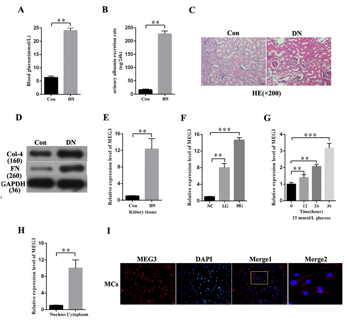 Long non-coding RNA MEG3 promotes fibrosis and inflammatory response in ...