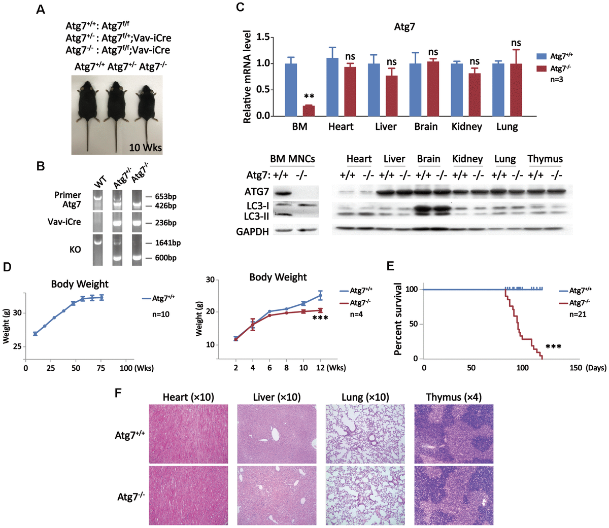 Blood autophagy defect causes accelerated non-hematopoietic organ aging ...