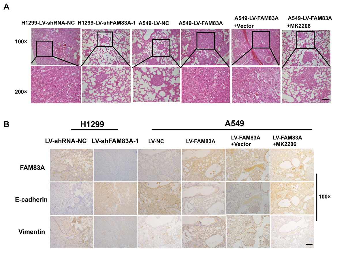 FAM83A signaling induces epithelial-mesenchymal transition by the PI3K ...