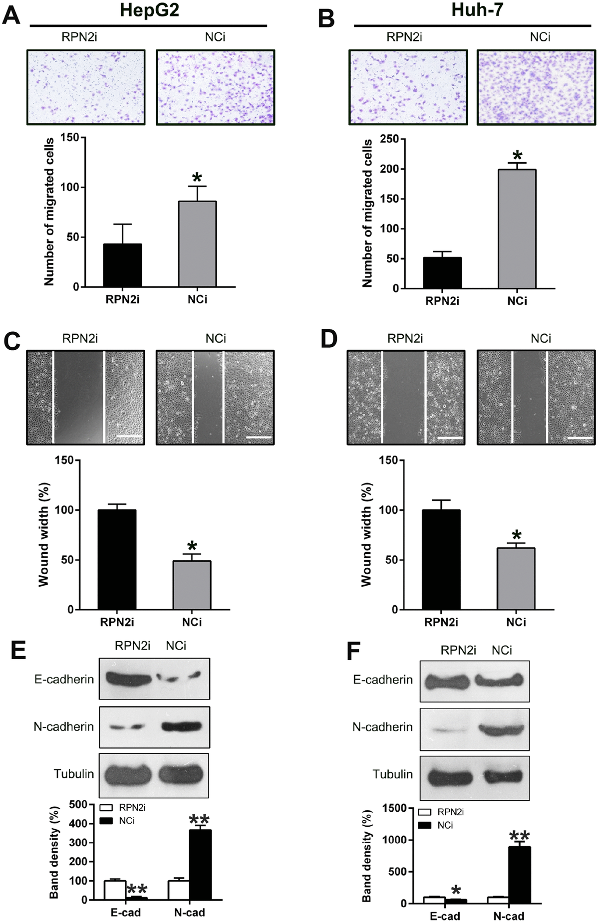RPN2 promotes metastasis of hepatocellular carcinoma cell and inhibits ...