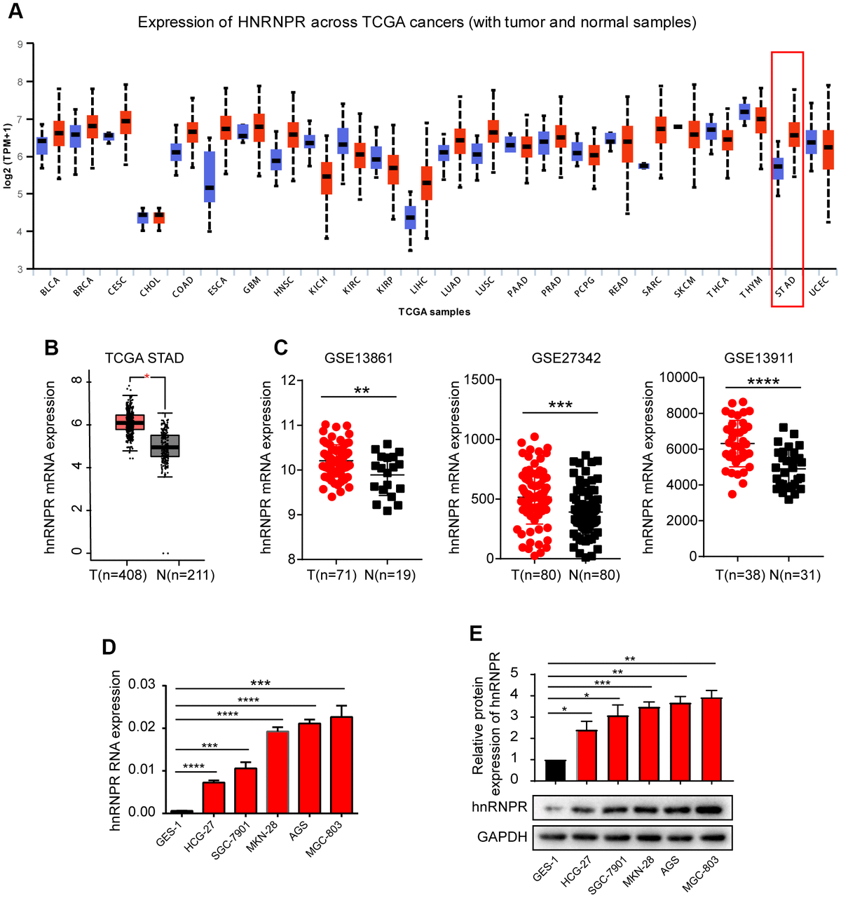 HnRNPR-CCNB1/CENPF axis contributes to gastric cancer proliferation and ...
