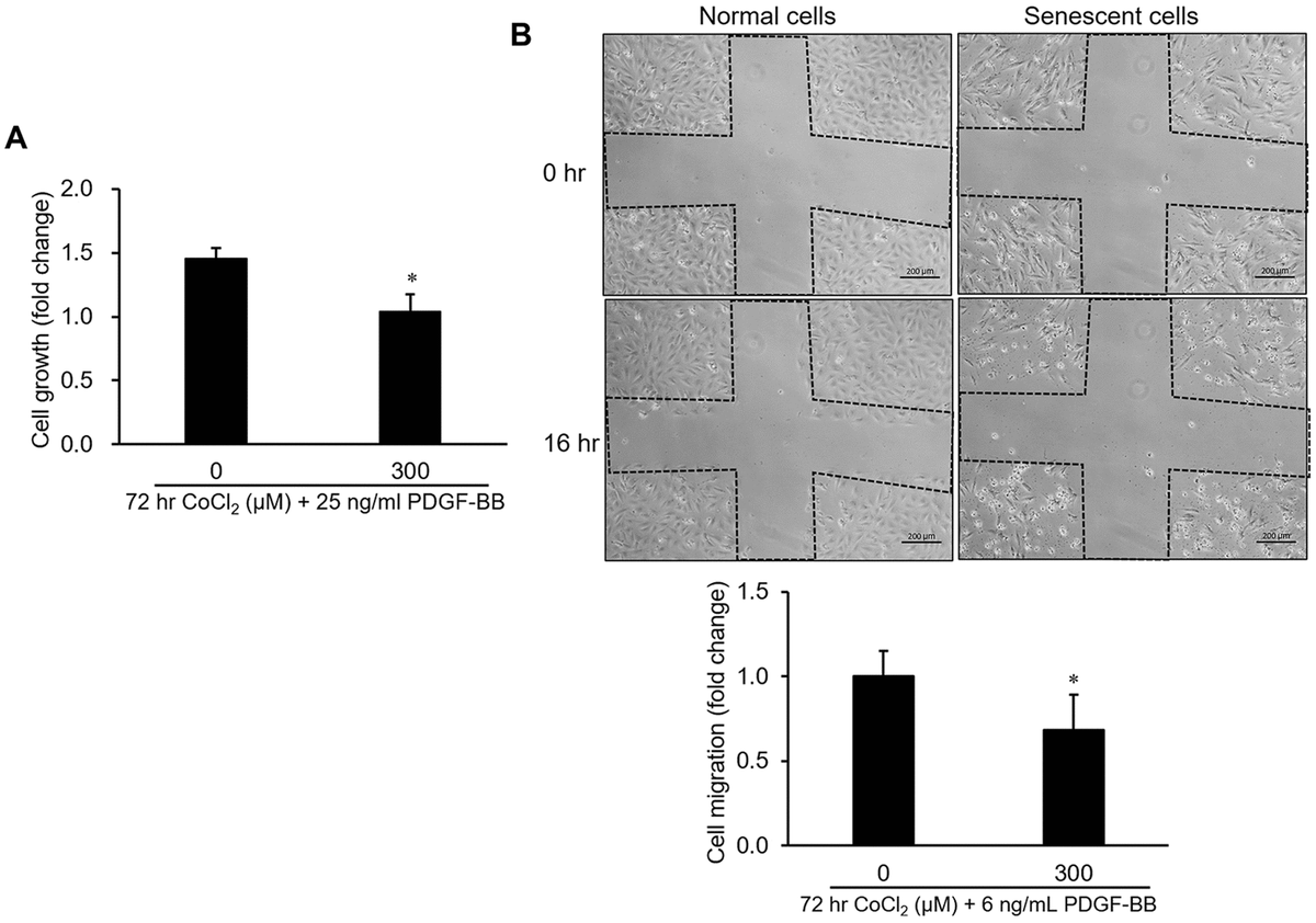 Oxidative stress-induced cellular senescence desensitizes cell growth and migration of vascular ...