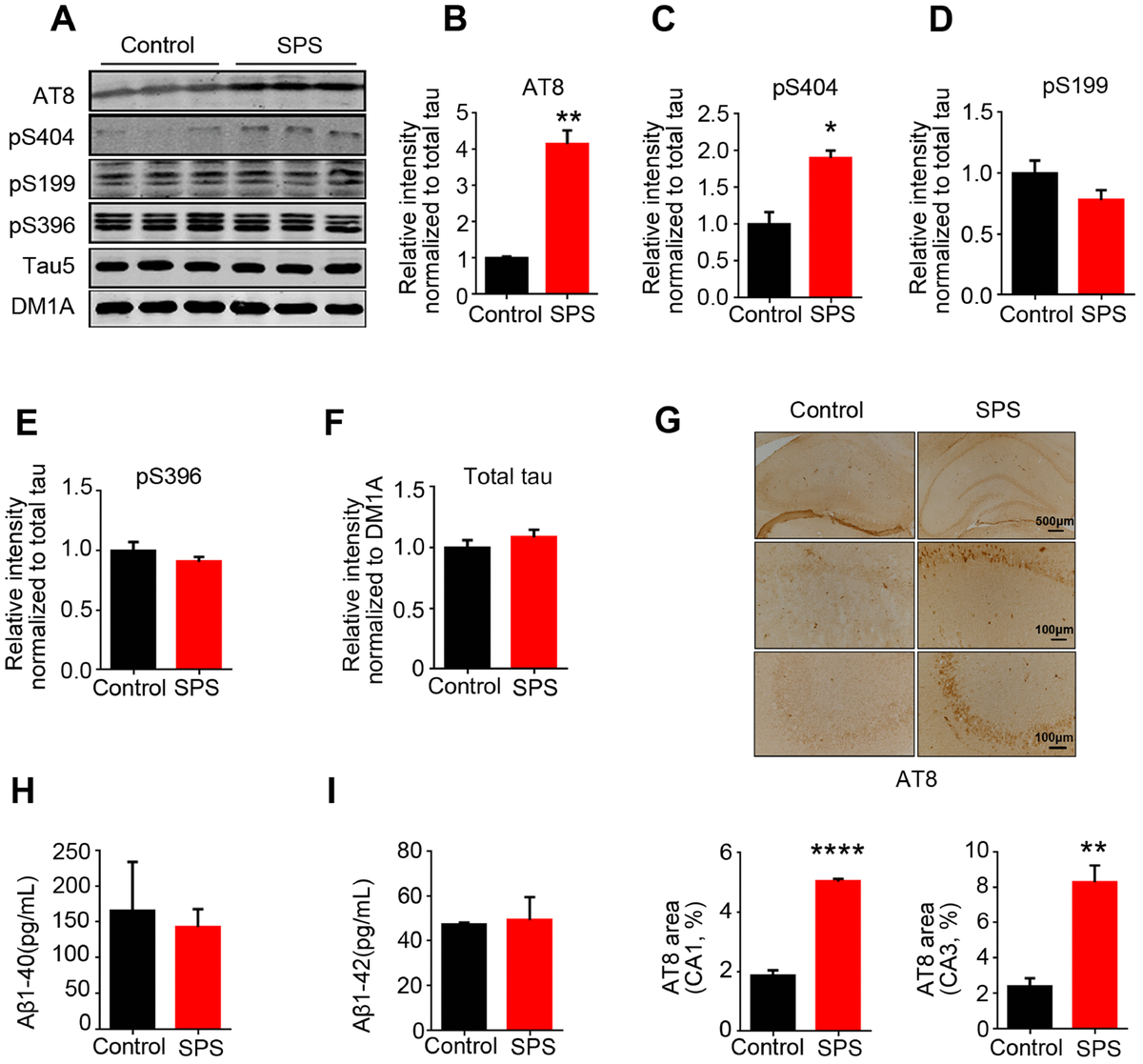 GSK-3β and ERK1/2 incongruously act in tau hyperphosphorylation in SPS ...