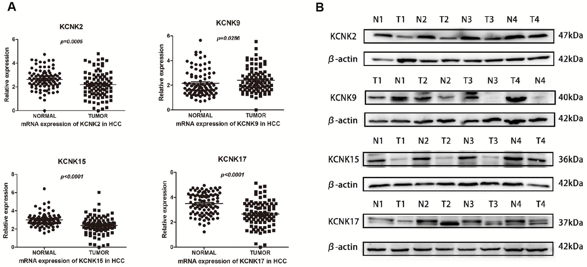 KCNK levels are prognostic and diagnostic markers for hepatocellular ...