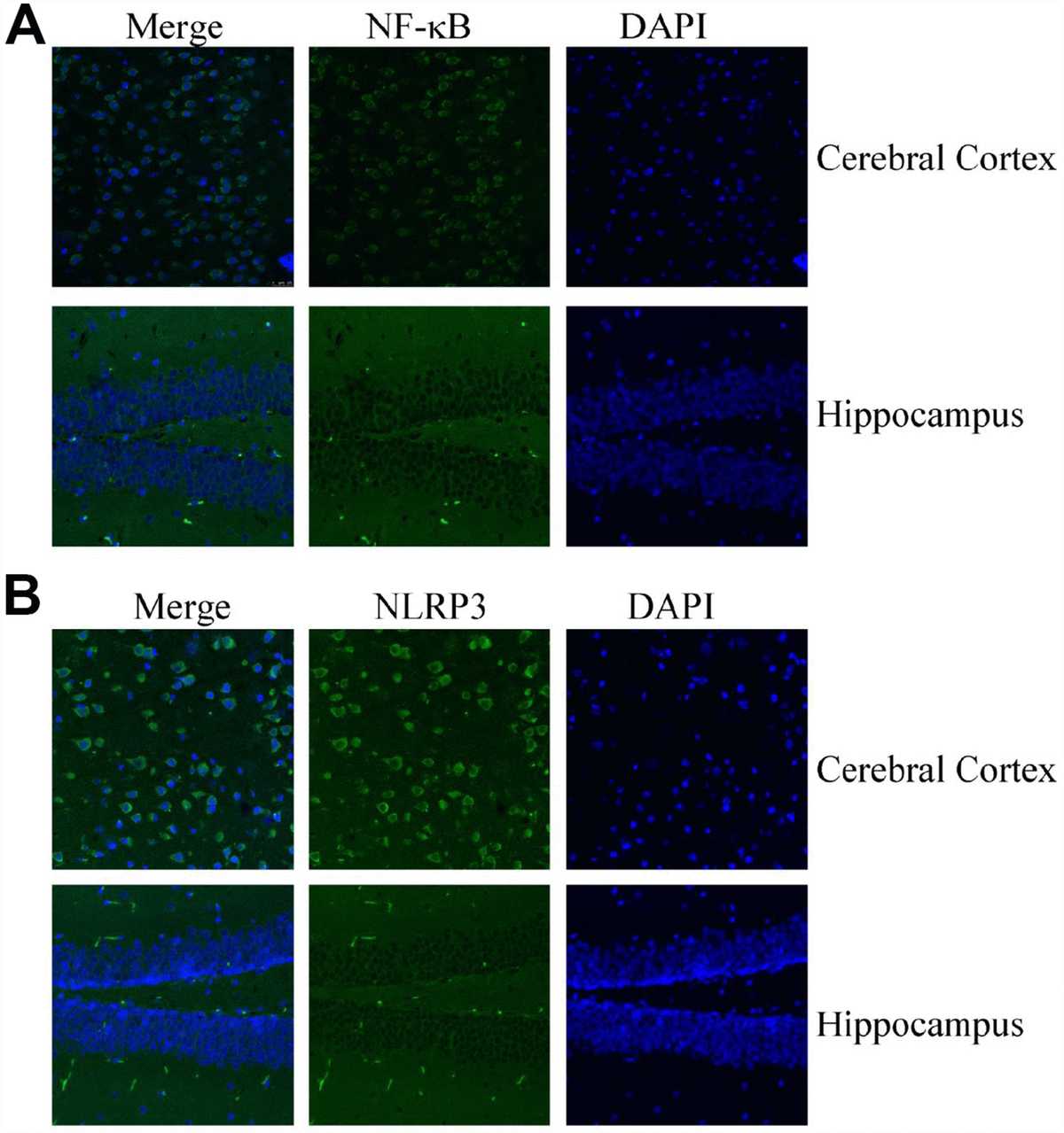 Kainic acid hyperphosphorylates tau via inflammasome activation in MAPT ...