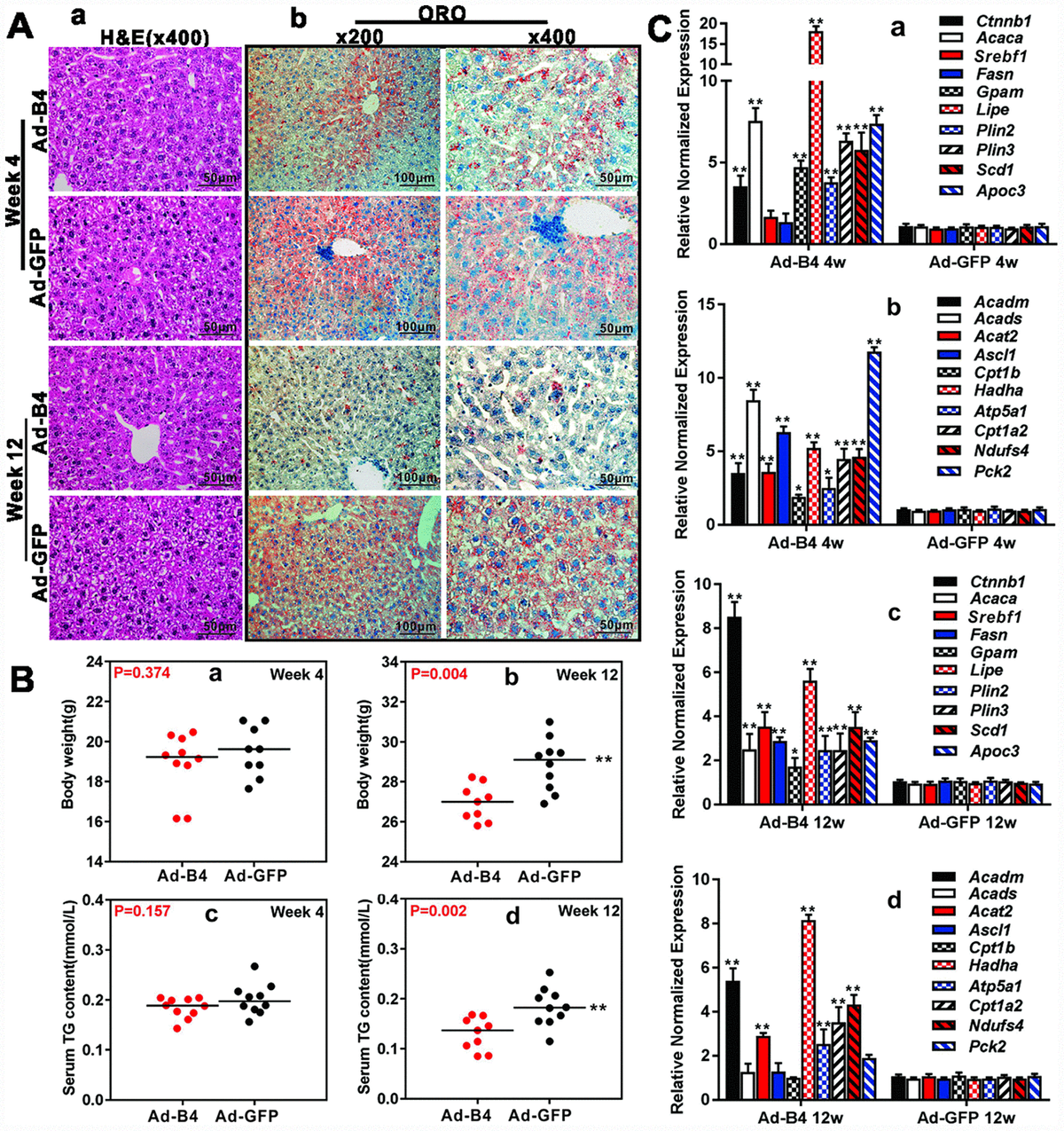 Bone morphogenetic protein 4 (BMP4) alleviates hepatic steatosis by ...
