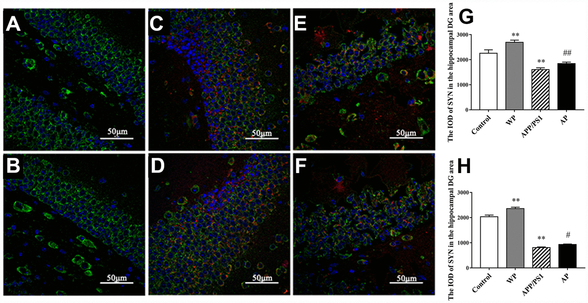Activation of α7 nAChR by PNU-282987 improves synaptic and cognitive ...