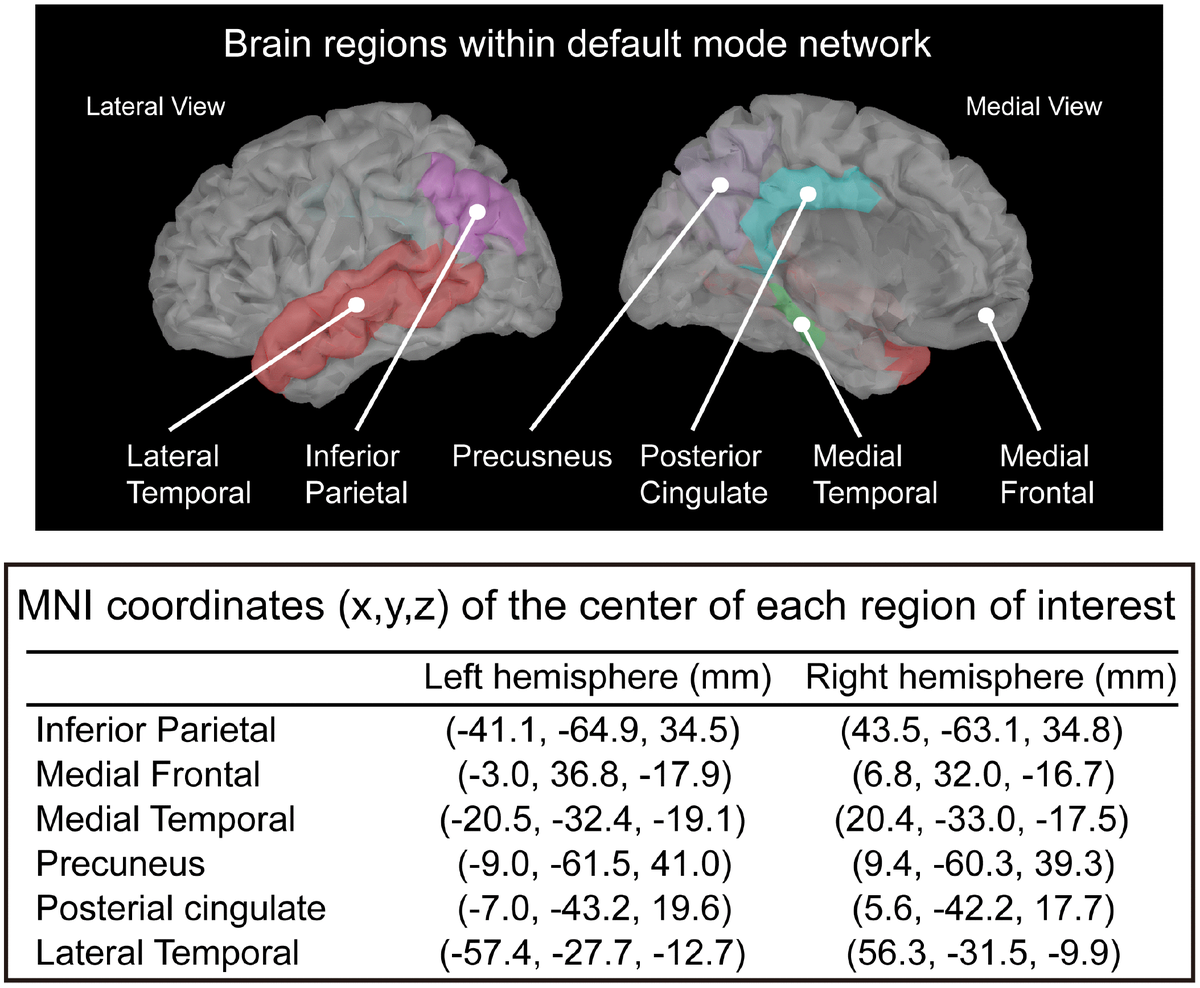 Subjective cognitive decline detected by the oscillatory connectivity ...