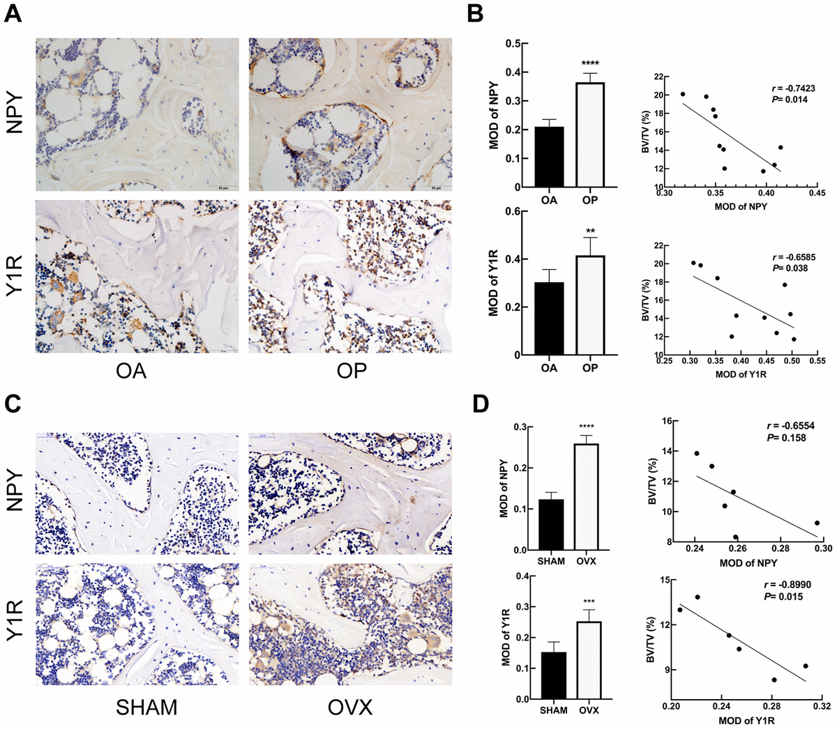 Neuropeptide Y1 receptor antagonist promotes osteoporosis and ...