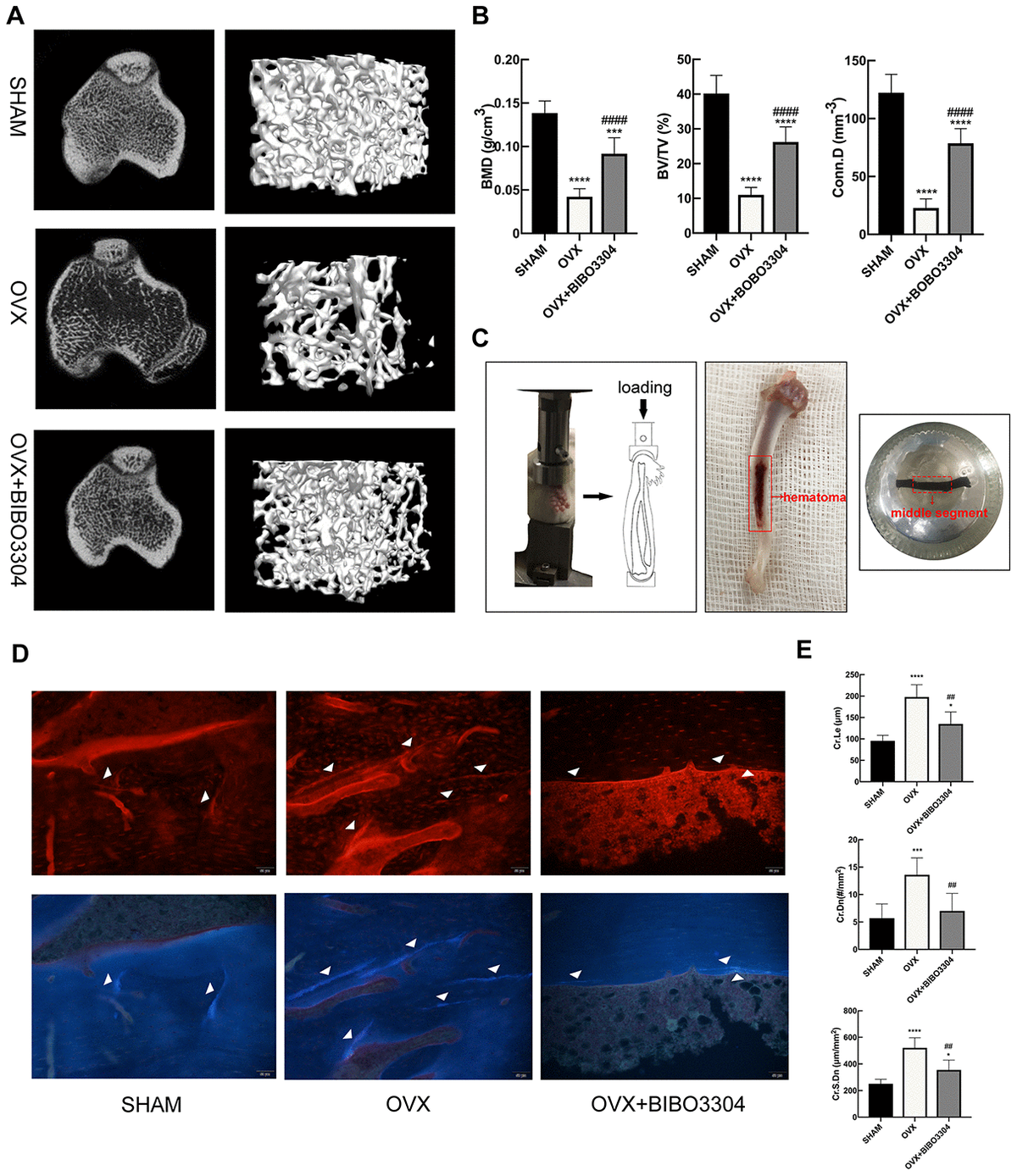 Neuropeptide Y1 receptor antagonist promotes osteoporosis and ...