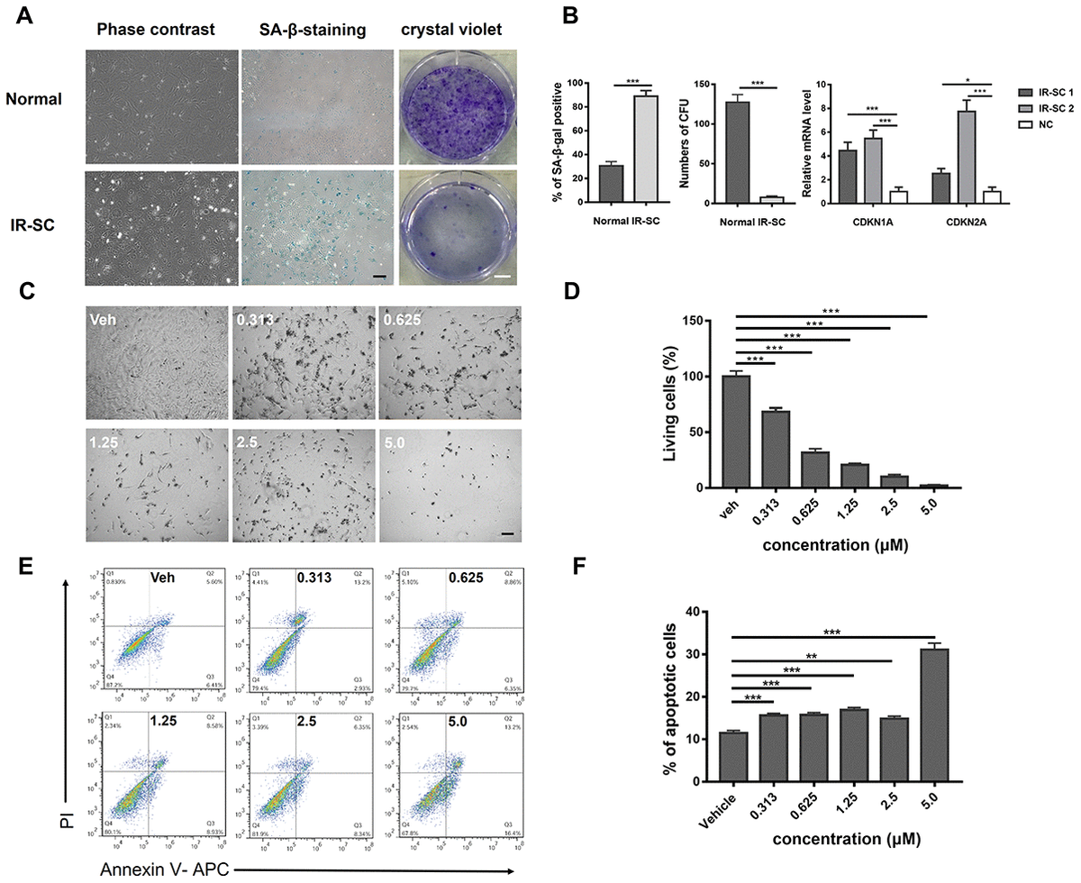 Navitoclax (ABT263) reduces inflammation and promotes chondrogenic ...