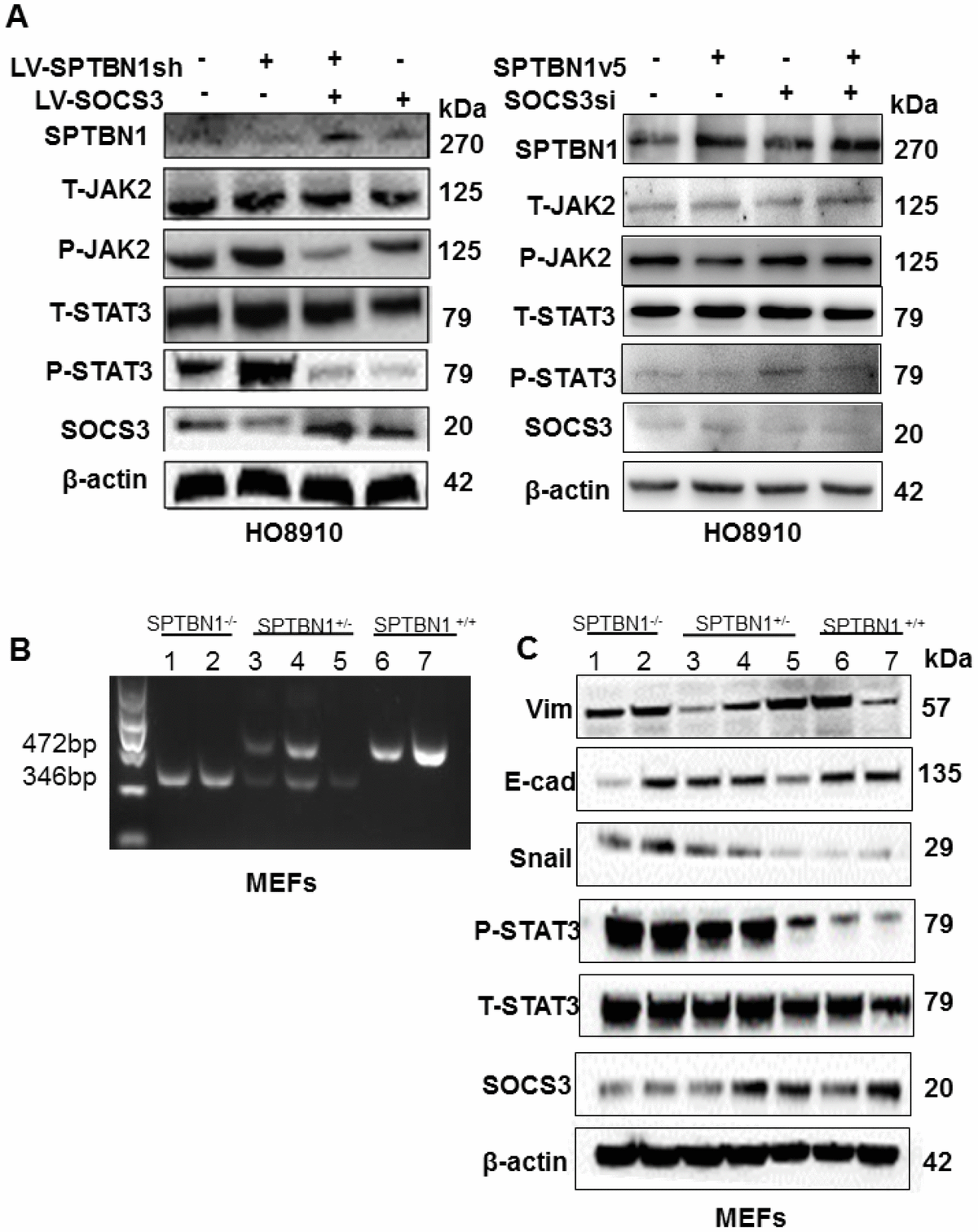 SPTBN1 suppresses the progression of epithelial ovarian cancer via ...