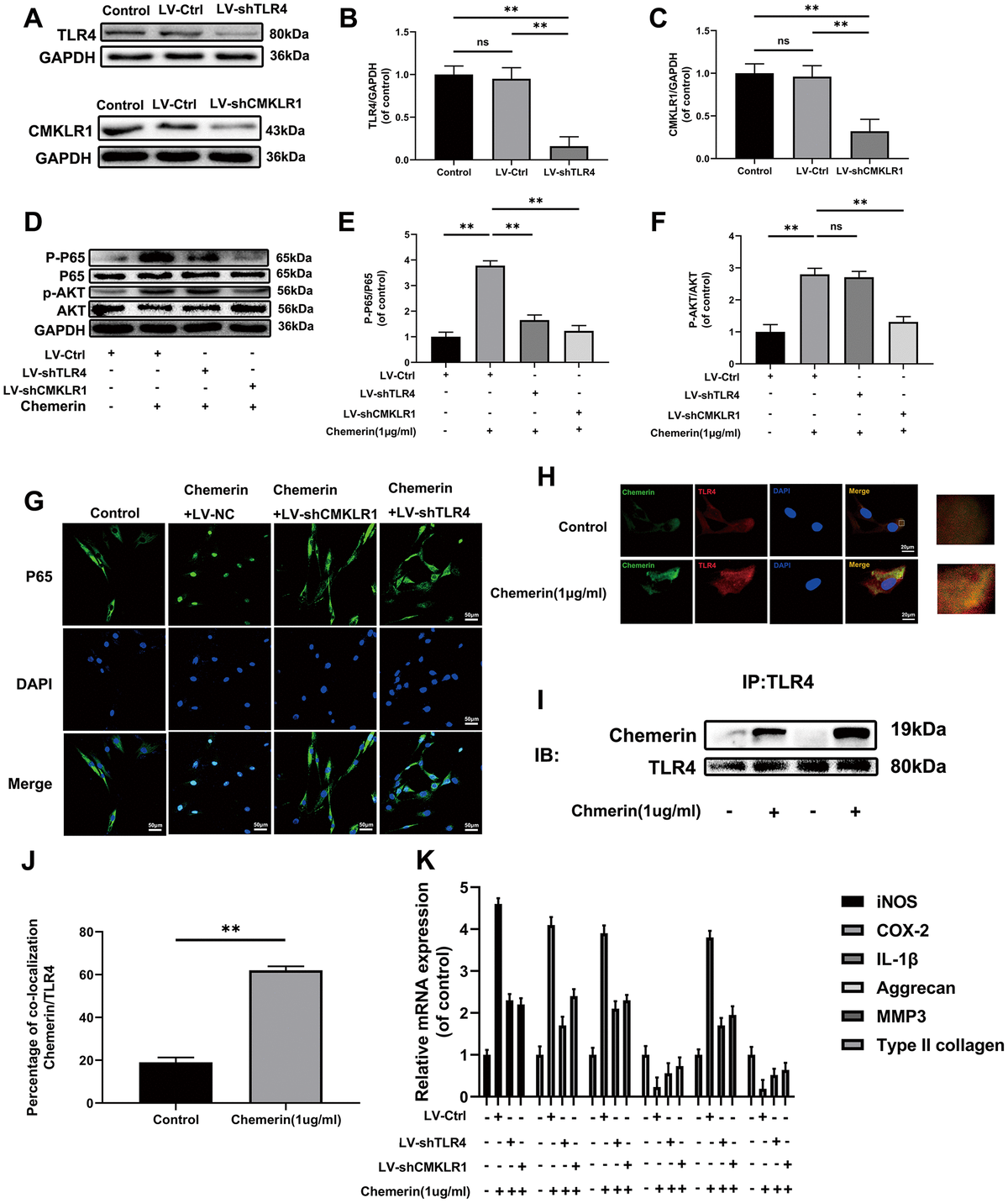 Chemerin facilitates intervertebral disc degeneration via TLR4 and ...