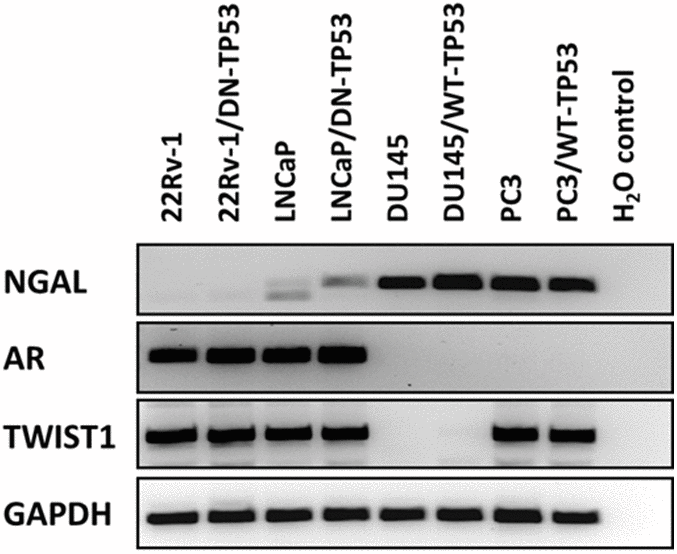 Influences of TP53 and the anti-aging DDR1 receptor in controlling Raf ...