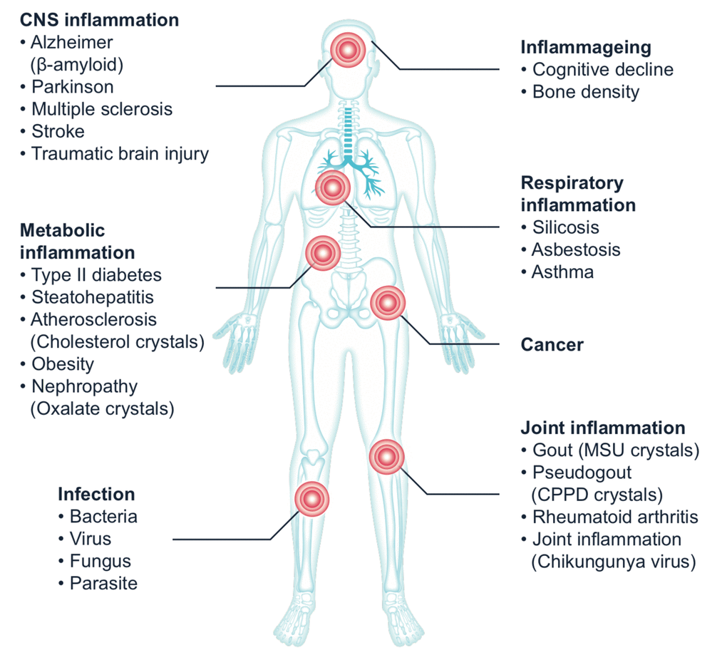 PANoptosis components, regulation, and implications | Aging