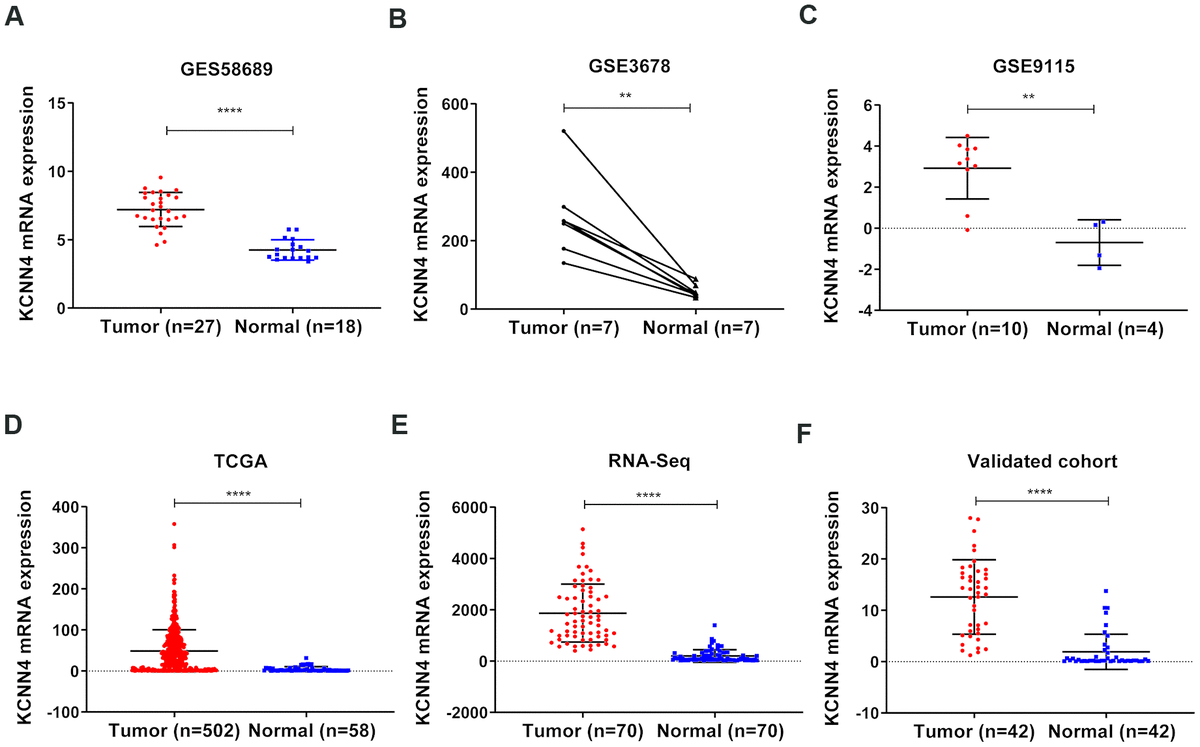 KCNN4 is a diagnostic and prognostic biomarker that promotes papillary ...