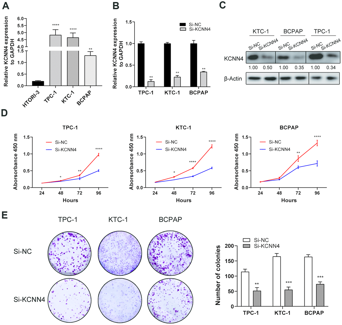 KCNN4 is a diagnostic and prognostic biomarker that promotes papillary ...