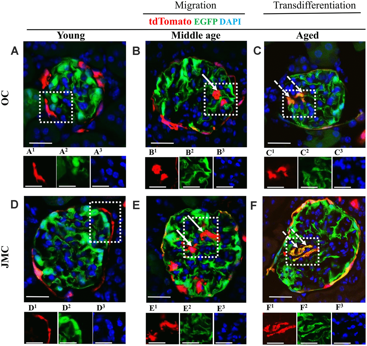Parietal epithelial cell differentiation to a podocyte fate in the aged ...