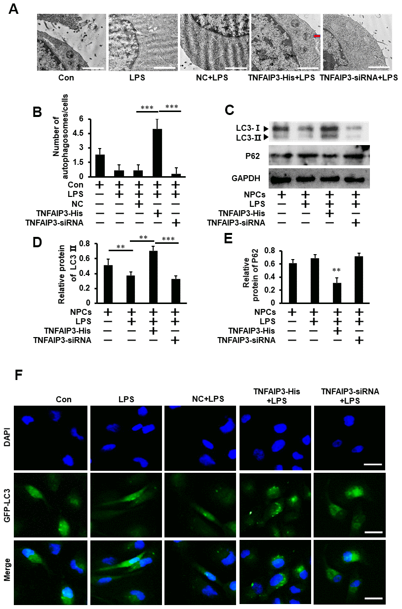 TNFAIP3 ameliorates the degeneration of inflammatory human nucleus ...