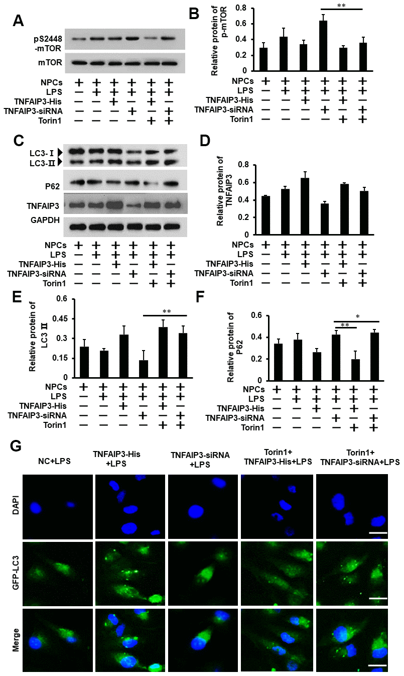 TNFAIP3 ameliorates the degeneration of inflammatory human nucleus ...
