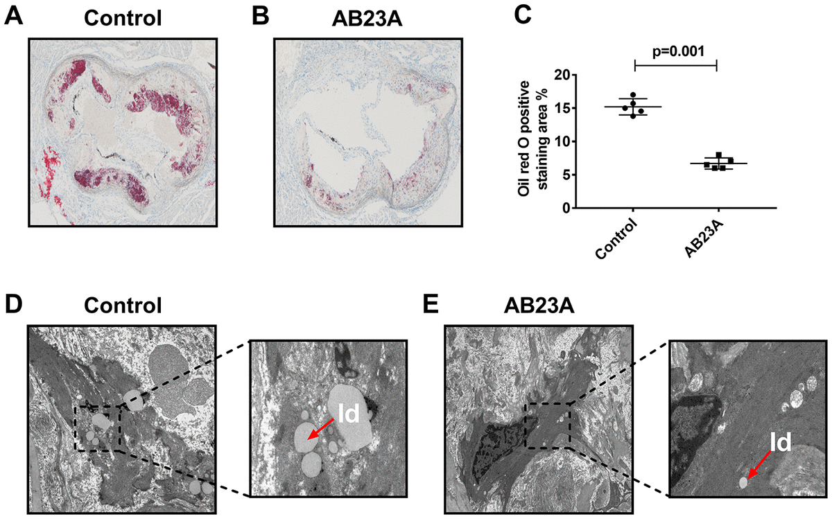 Alisol B 23-acetate activates ABCG5/G8 in the jejunum via the LXRα ...