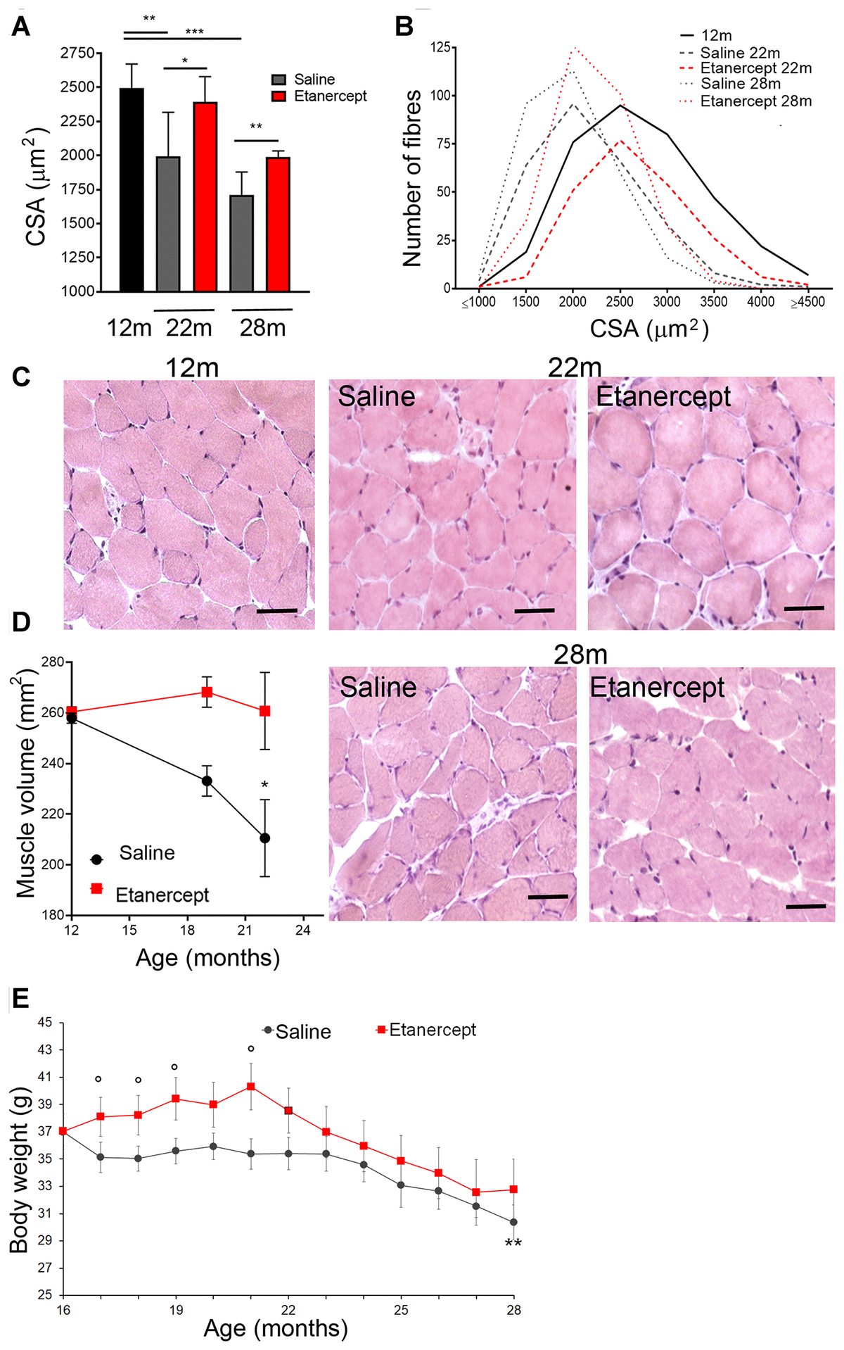Pharmacological blockade of TNFα prevents sarcopenia and prolongs ...