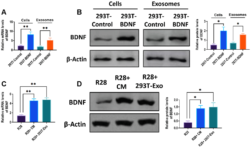Exosomes derived from BDNF-expressing 293T attenuate ischemic retinal ...