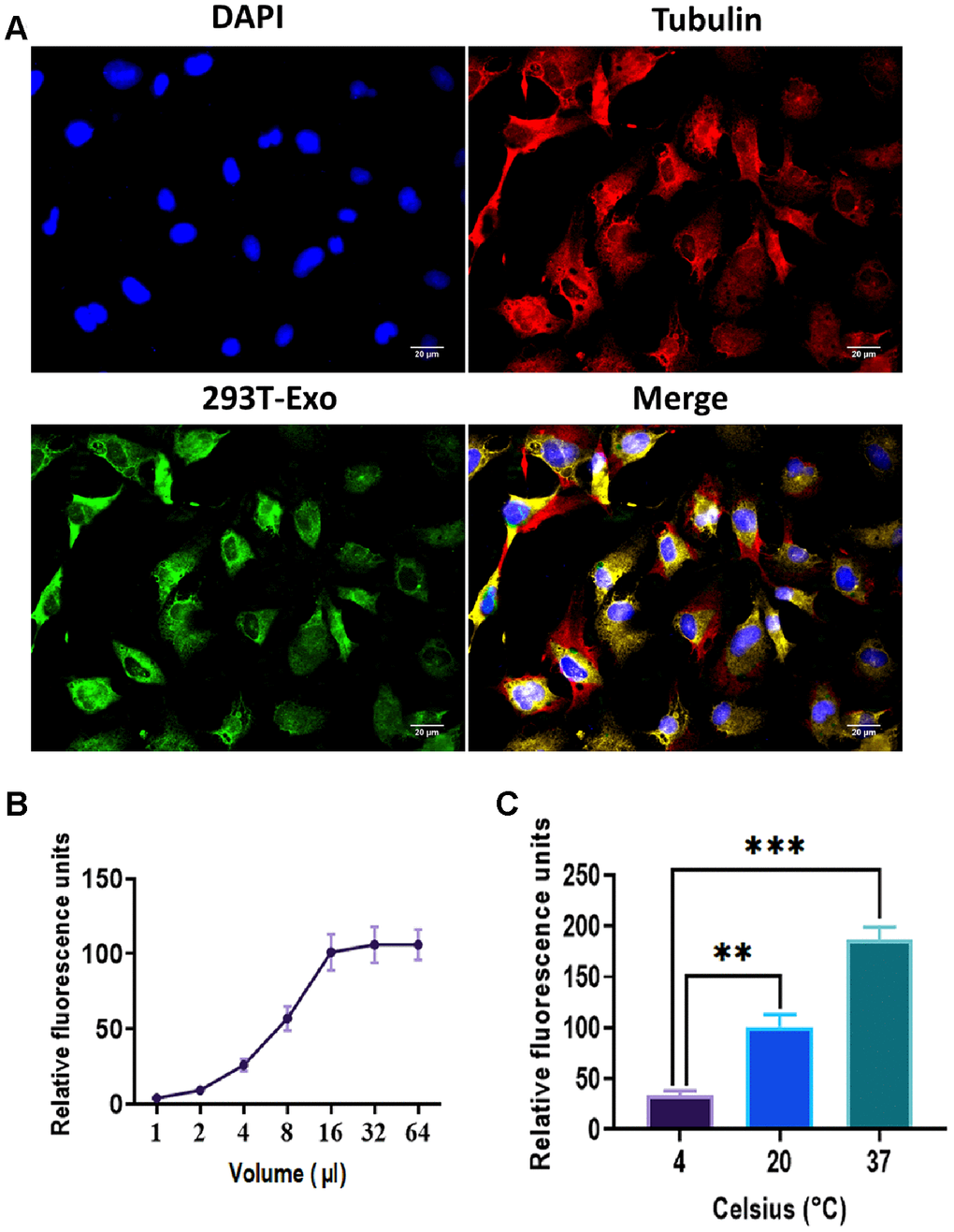 Exosomes derived from BDNF-expressing 293T attenuate ischemic retinal ...