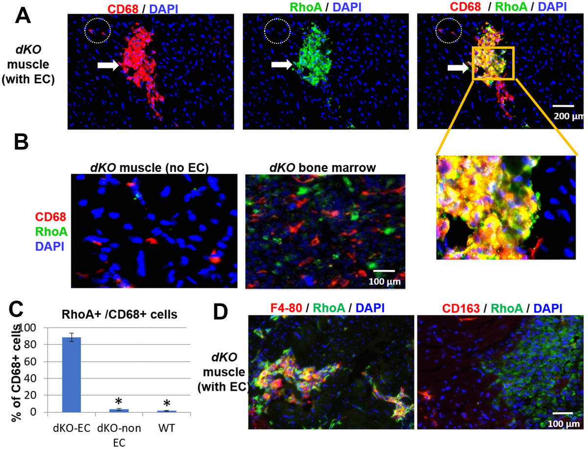 Aberrant RhoA activation in macrophages increases senescence-associated ...