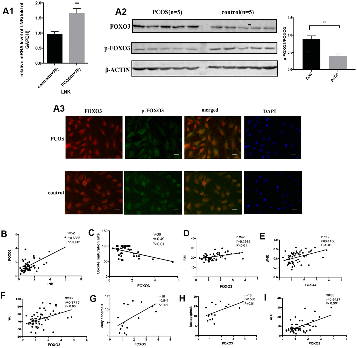LNK promotes granulosa cell apoptosis in PCOS via negatively regulating ...