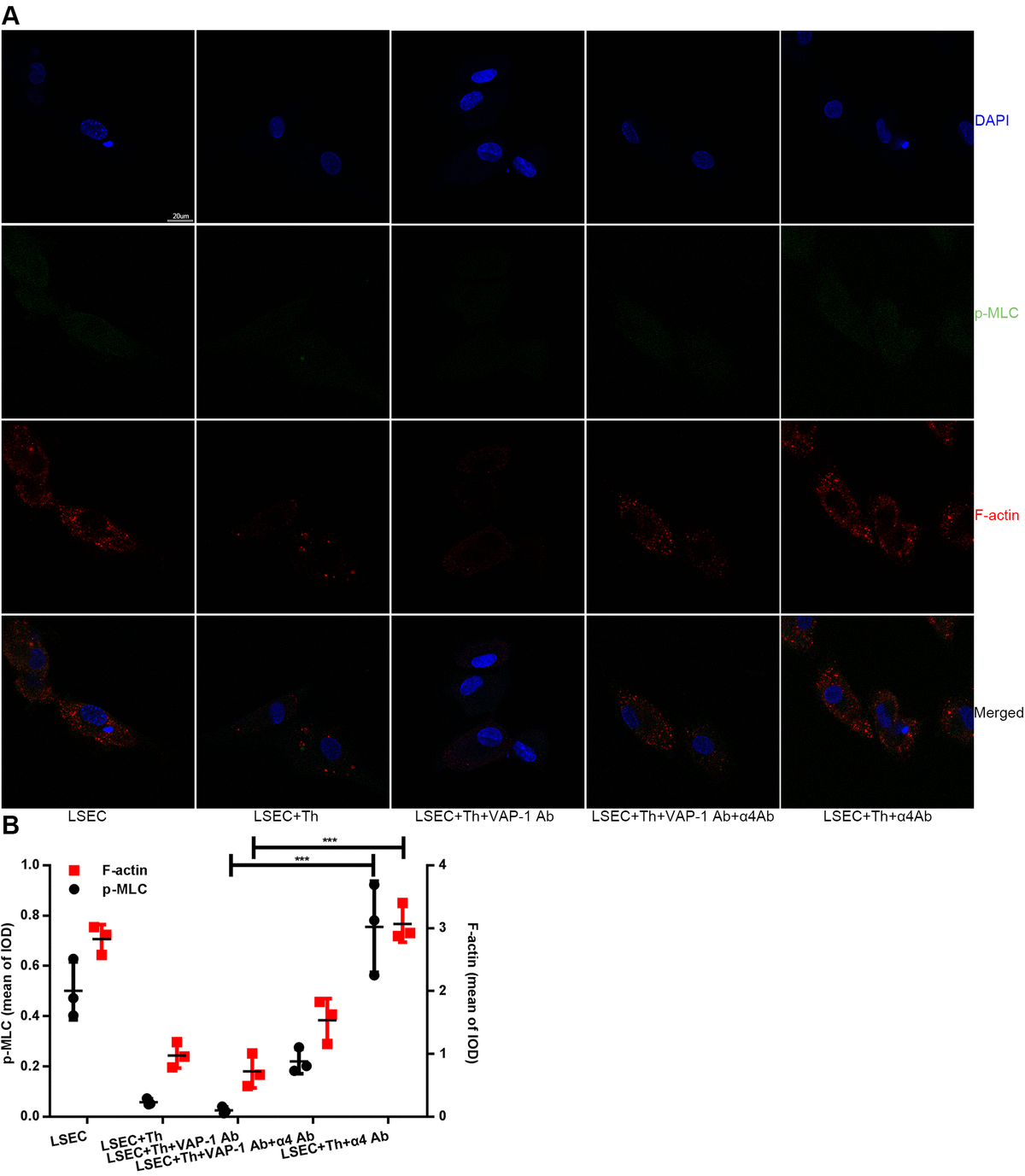 Inhibiting Th1/2 cells influences hepatic capillarization by adjusting ...