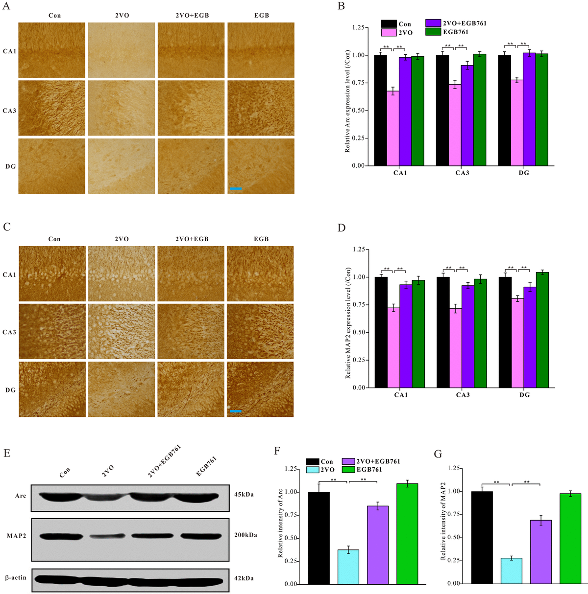 EGB761 ameliorates chronic cerebral hypoperfusion-induced cognitive ...