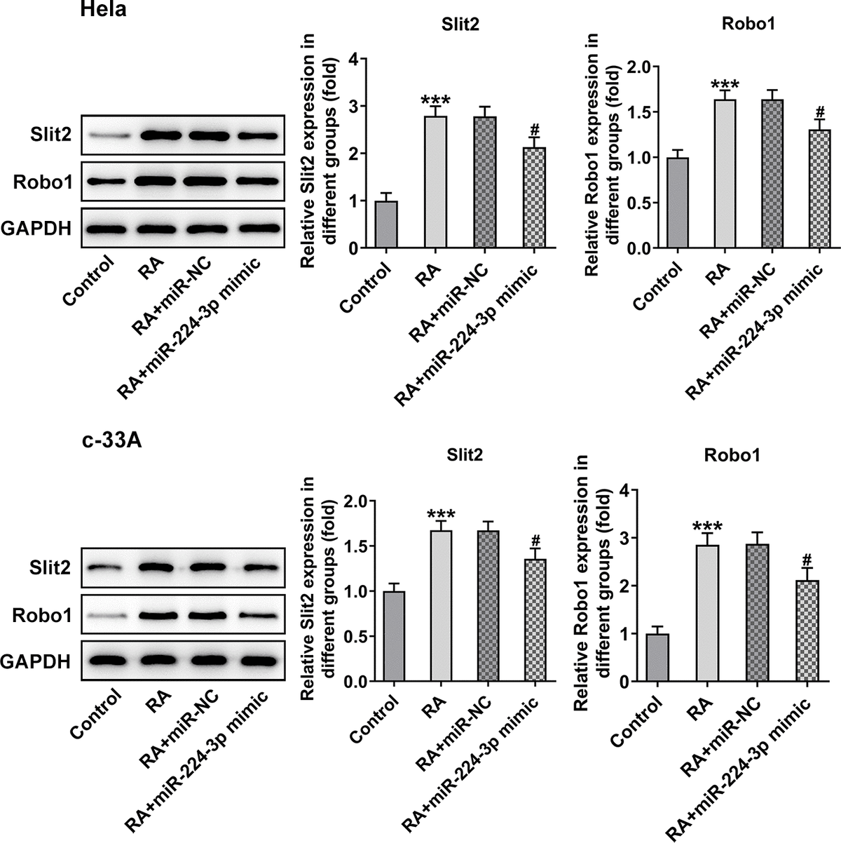 Raddeanin A inhibits proliferation, invasion, migration and promotes ...