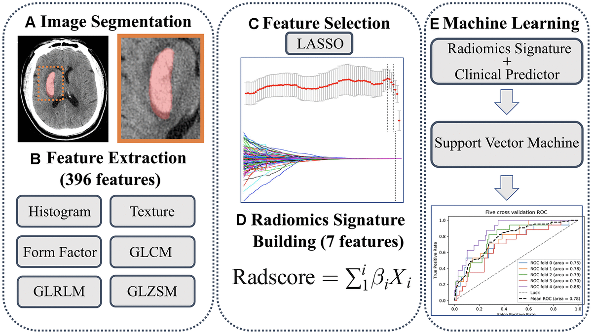 Predicting intraventricular hemorrhage growth with a machine learning ...