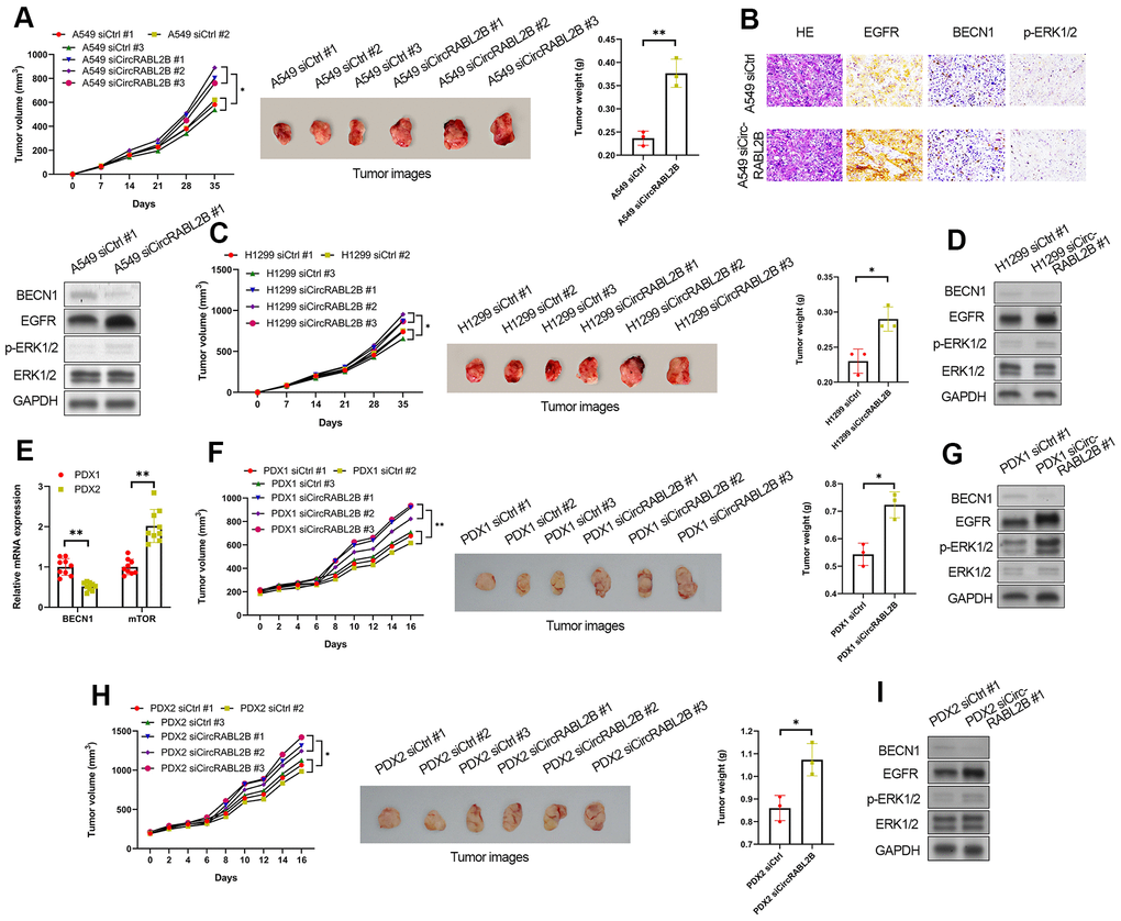 The circular RNA circRABL2B promotes non-small cell lung cancer ...