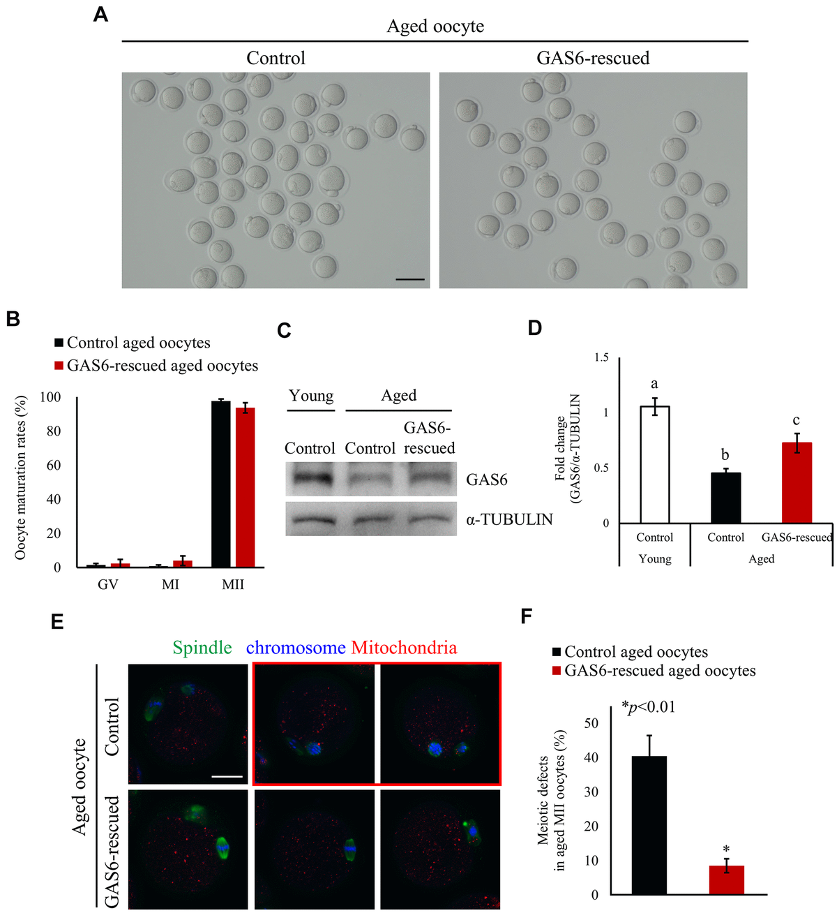 GAS6 ameliorates advanced age-associated meiotic defects in mouse ...