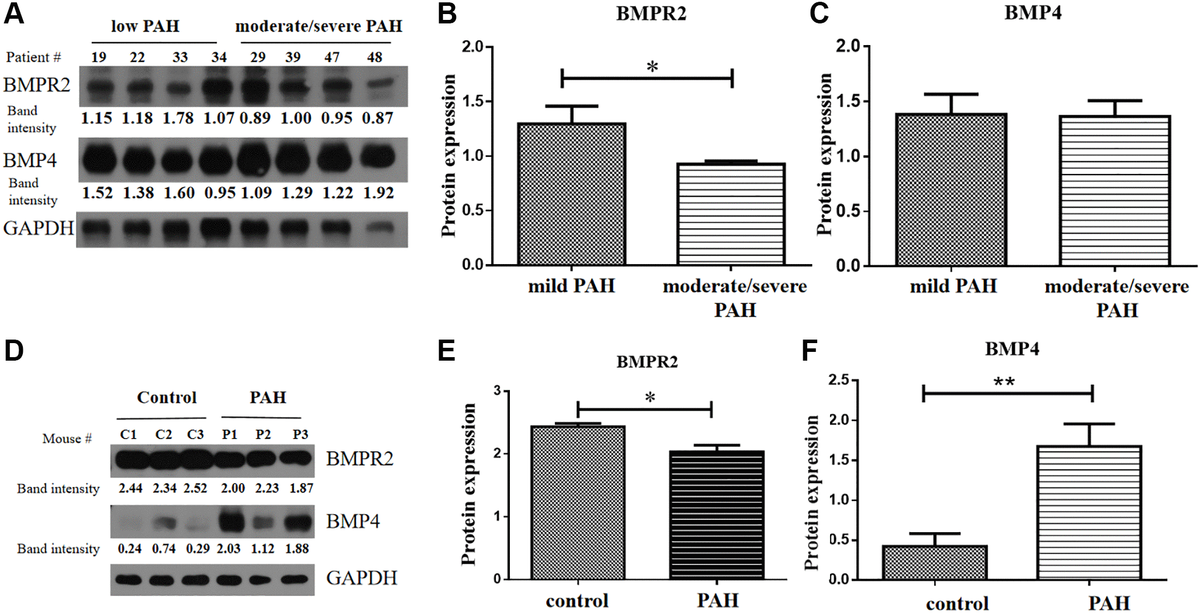 BMPR2 promoter methylation and its expression in valvular heart disease ...