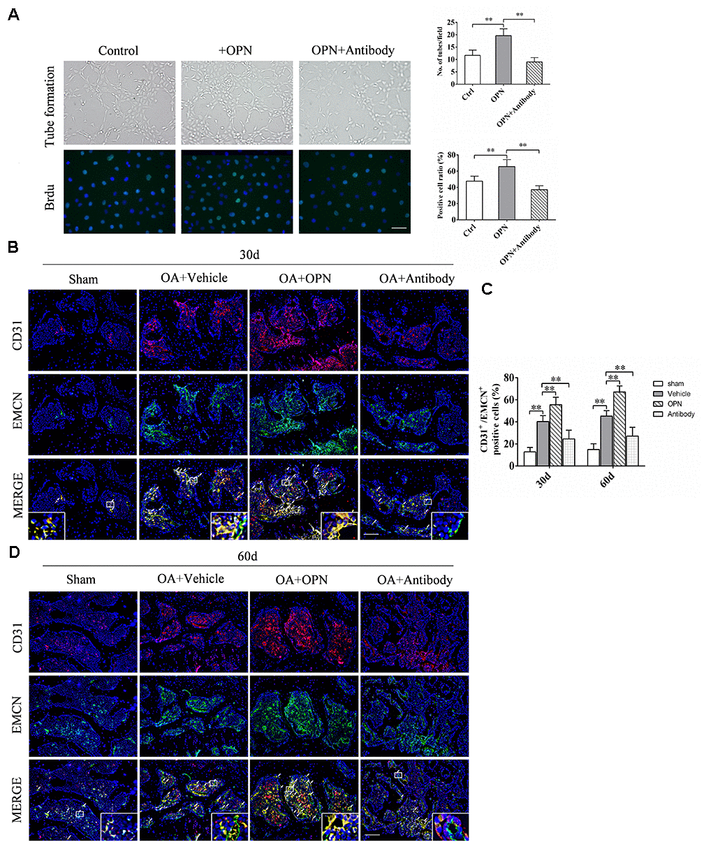 Increased expression of osteopontin in subchondral bone promotes bone ...