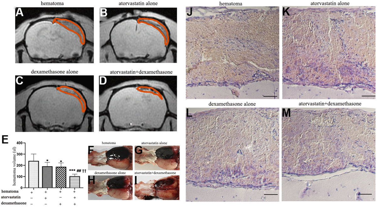Atorvastatin combined with dexamethasone promote hematoma absorption in ...