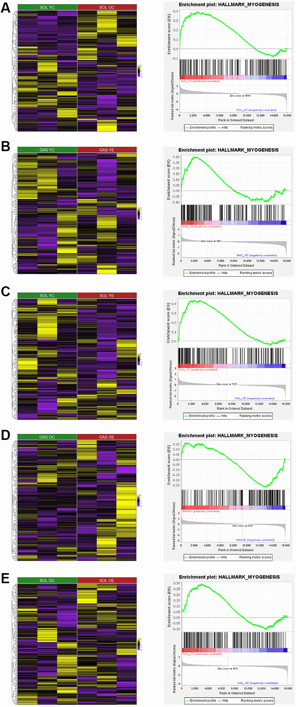 Muscle fiber type-dependence effect of exercise on genomic networks in ...