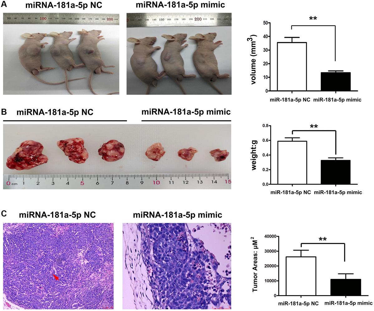 MicroRNA-181a-5p prevents the progression of esophageal squamous cell ...