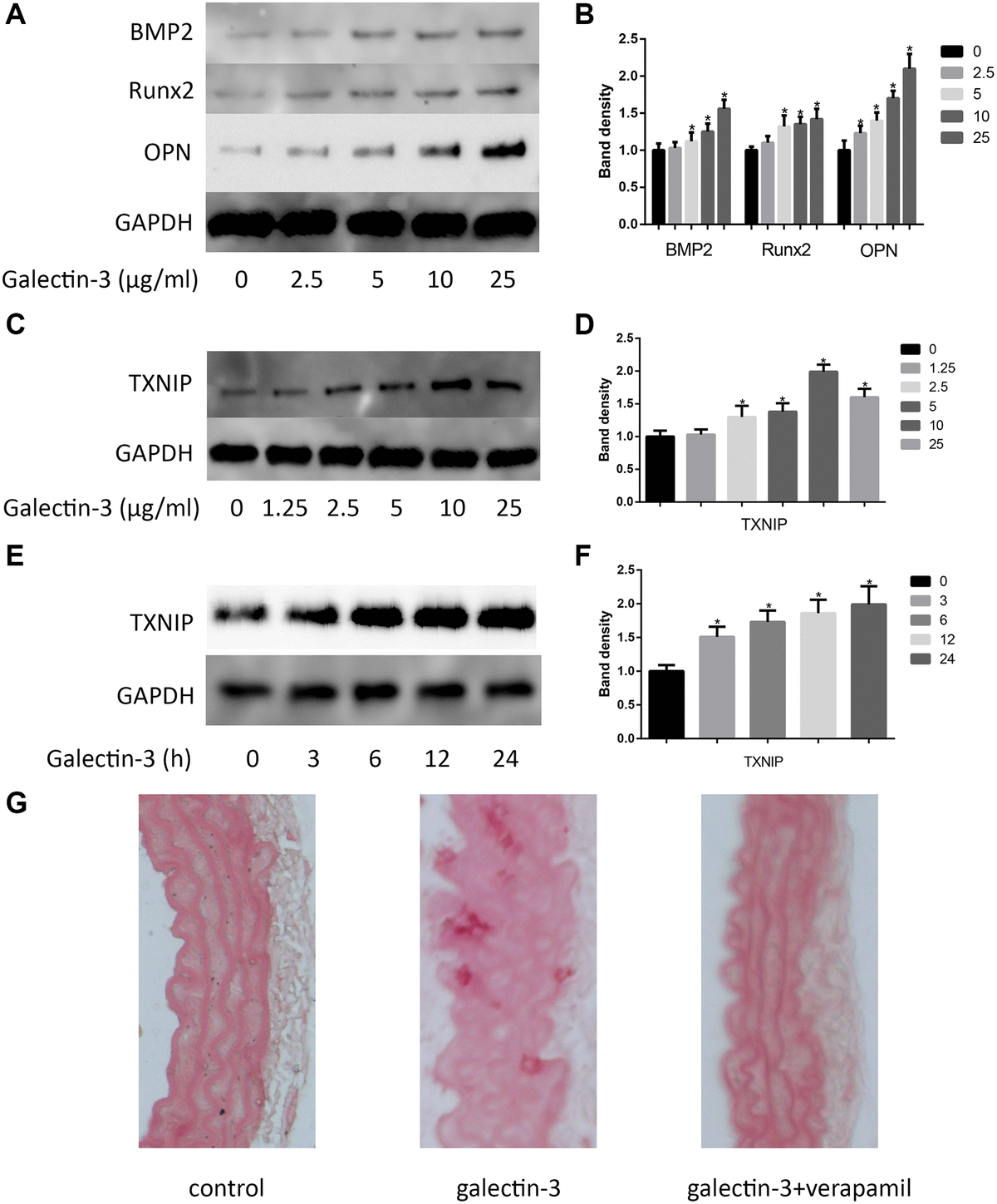 Galectin-3 induces vascular smooth muscle cells calcification via AMPK ...