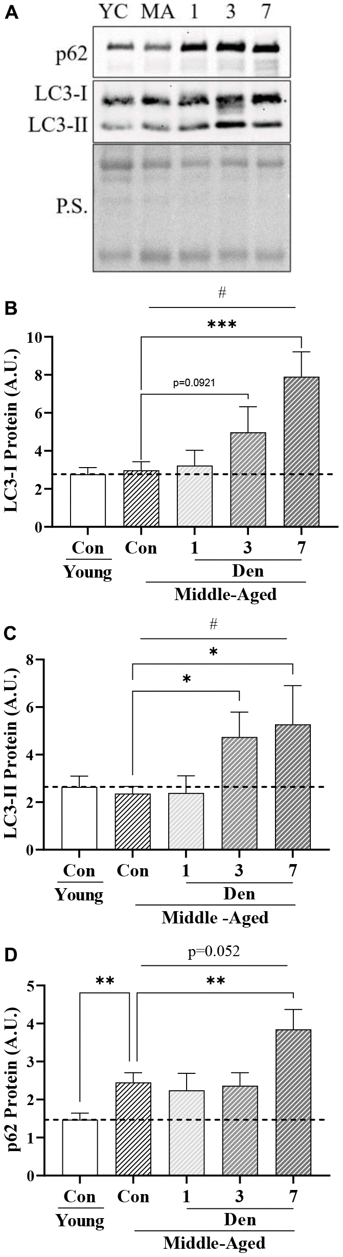 Denervation induces mitochondrial decline and exacerbates lysosome ...