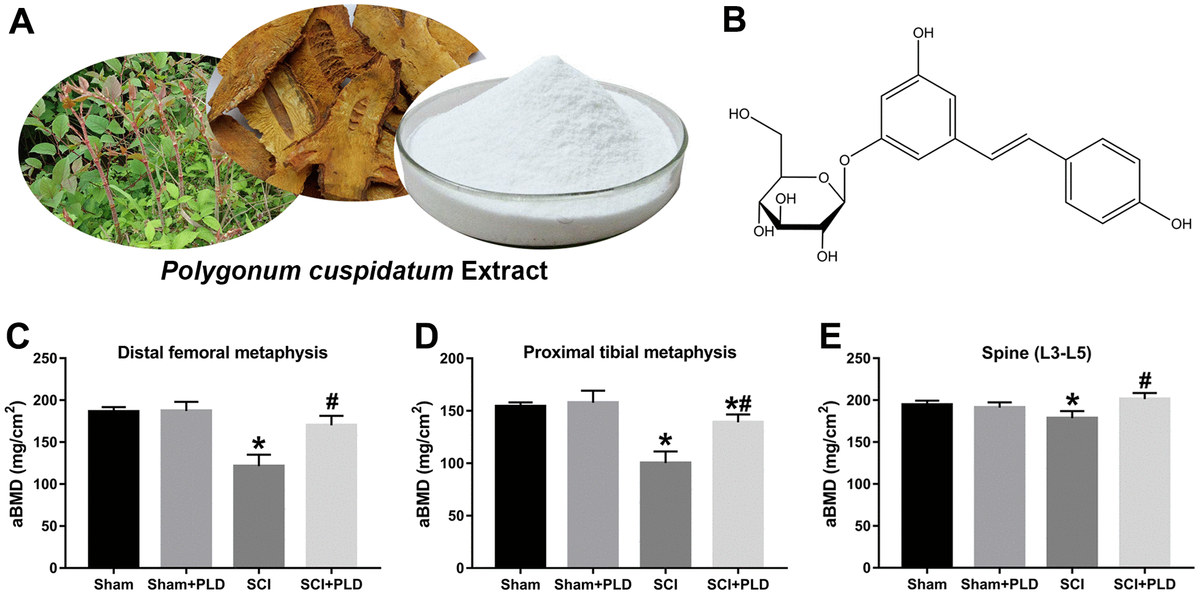 Polydatin administration attenuates the severe sublesional bone loss in ...